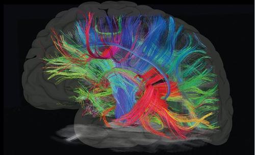 DWI（磁共振扩散张量成像）——MRI笔记 - 知乎
