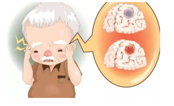 意识障碍(嗜睡、意识模糊、昏睡、谵妄、昏迷) 知乎