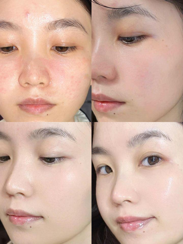 双十一国货美白精华推荐 2个月脸美白祛黄了2个度，难怪是【内行人】公认最有效的美白精华！ 知乎