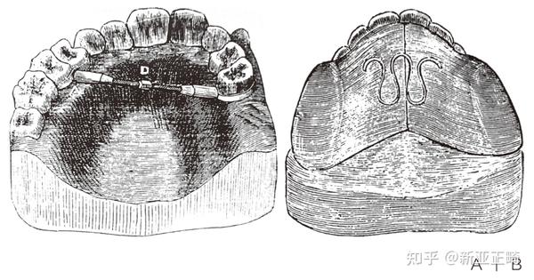 口腔正畸学发展史（上） - 知乎