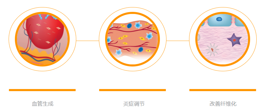 里程碑突破｜Celution设备首获NMPA第III类医疗器械注册证 - 知乎