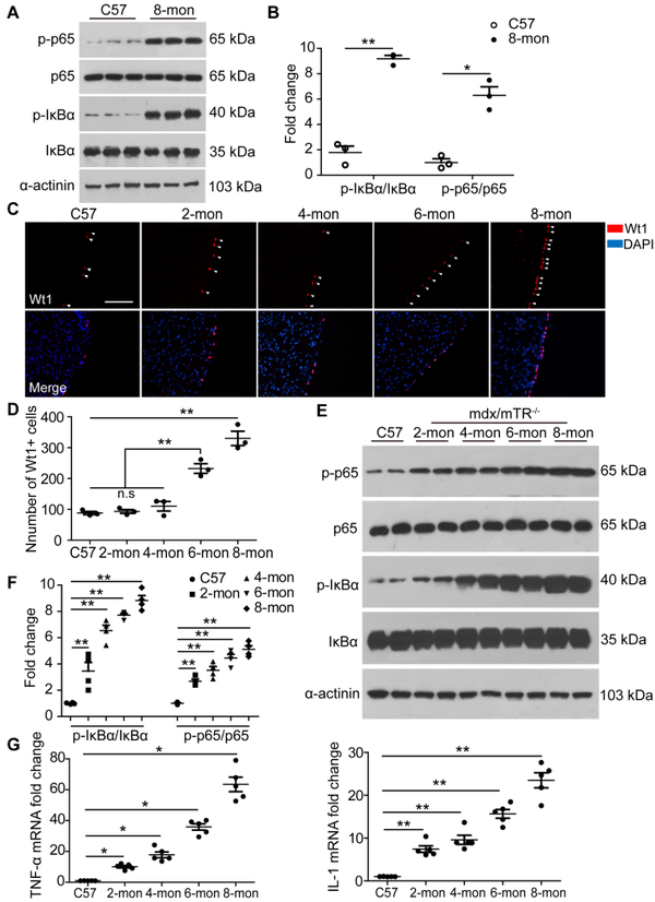 Cell Death Differ︱尹海芳团队揭示杜兴肌肉萎缩症新作用机制：转录因子Wt1激活心外膜细胞分化促进心肌纤维化 - 知乎