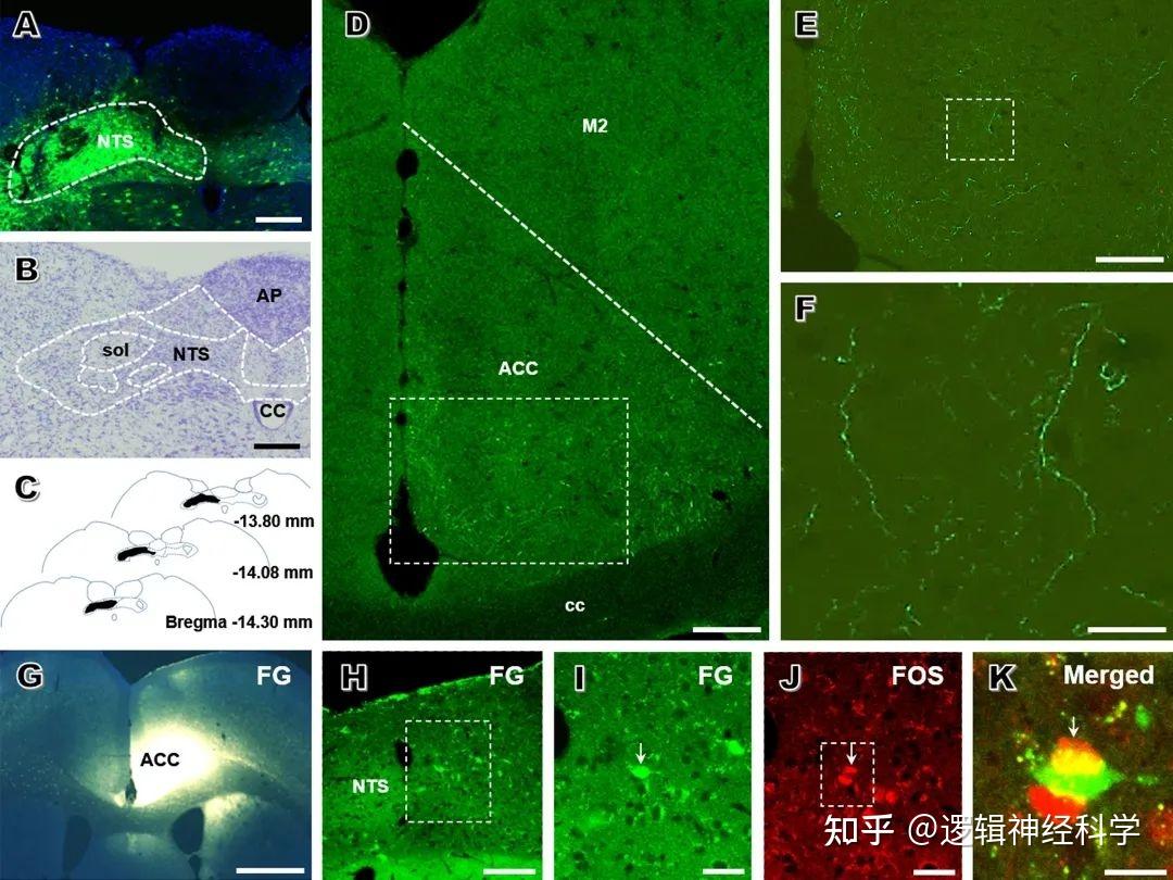 Neurosci Bull︱李云庆课题组揭示前扣带回内神经可塑性改变与慢性胰腺炎的痛觉过敏和焦虑有关 - 知乎