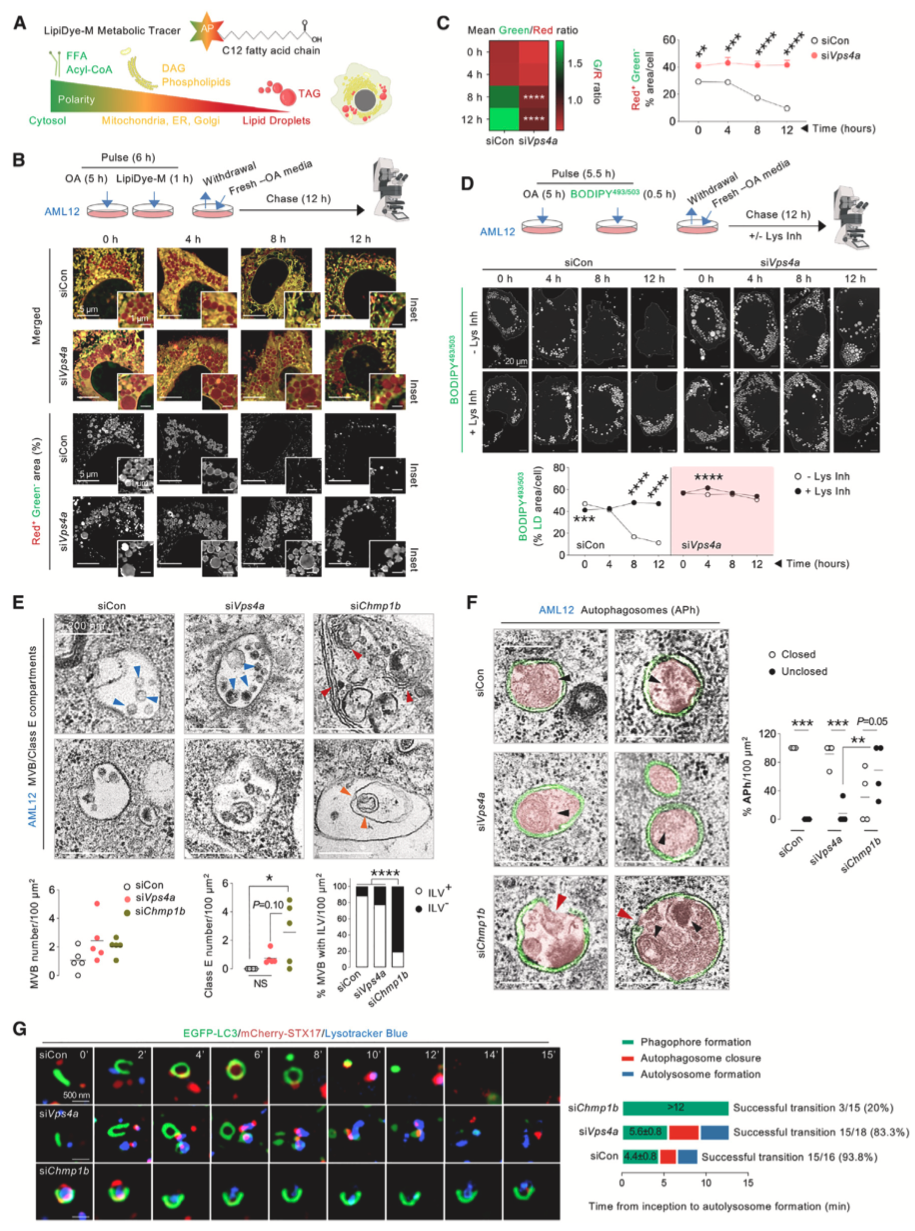 Molecular Cell丨VPS4A 是小鼠和人类脂噬的选择性受体 - 知乎