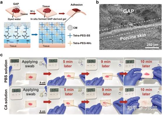 南科大吴德成《AFM》：4-arm-PEG凝胶化粘性止血粉，有效控制致命性出 - 知乎