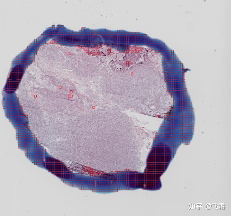 医学图像实战：病理学WSI图像的预处理 - 知乎