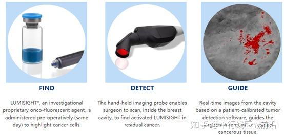 长文盘点|基于术中可视化的血管/神经/肿瘤荧光手术导航技术，精准外科手术蓄势待发 - 知乎