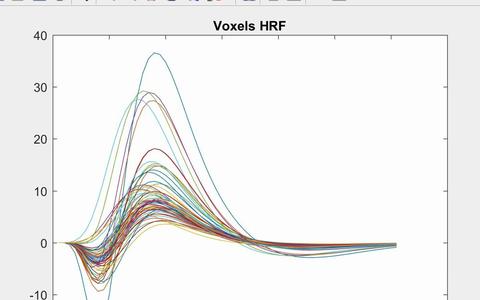 rsHRF：静息态血液动力学响应函数估计和去卷积工具包 - 知乎