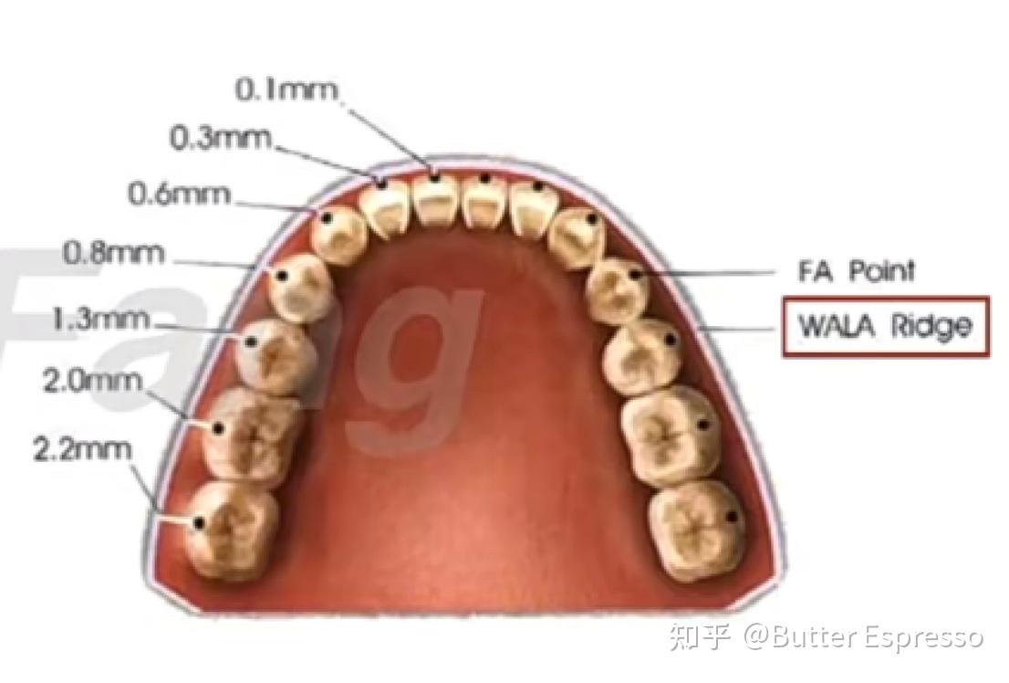 提炼知识点：“36计让你精通隐形矫正——王芳”（01） - 知乎