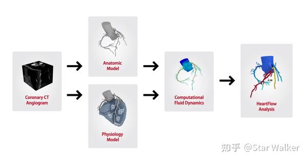 关于冠脉血流储备分数FFR、QFR、FFRCT的简单笔记 - 知乎
