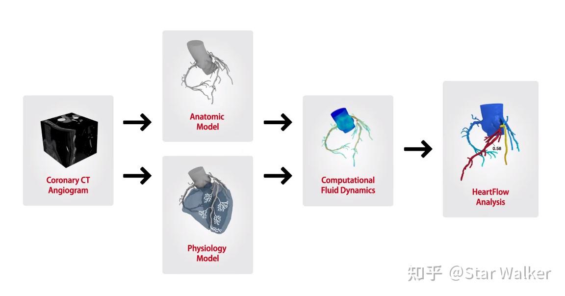 关于冠脉血流储备分数FFR、QFR、FFRCT的简单笔记 - 知乎