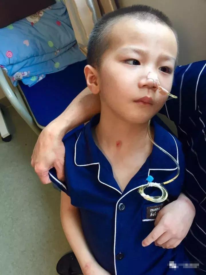 6岁孩子被继母打到失明致残,现在亲妈也不要他了? 知乎