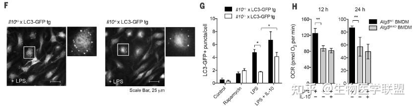 Science发文解释了炎症性肠病之谜：IL-10与巨噬细胞代谢的关键调控 - 知乎