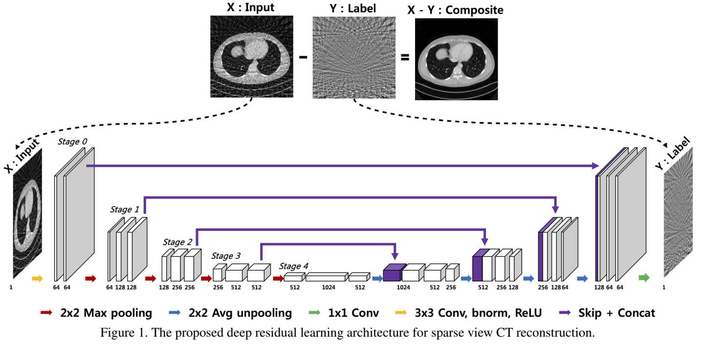 润物无声：深度学习赋能低剂量CT - 知乎