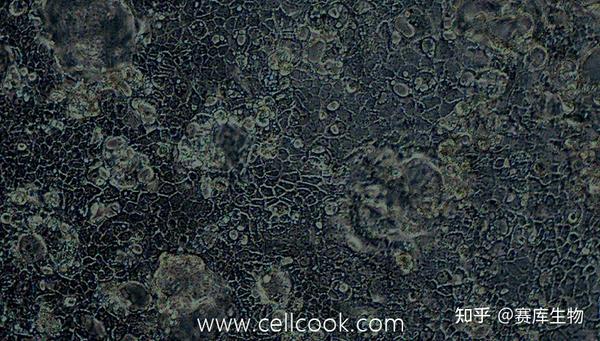 细胞学堂|Caco-2人结直肠腺癌细胞的生长特性及常见问题 - 知乎