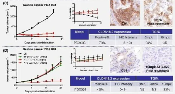 进展期胃癌靶向治疗之新星-Claudin 18.2 - 知乎
