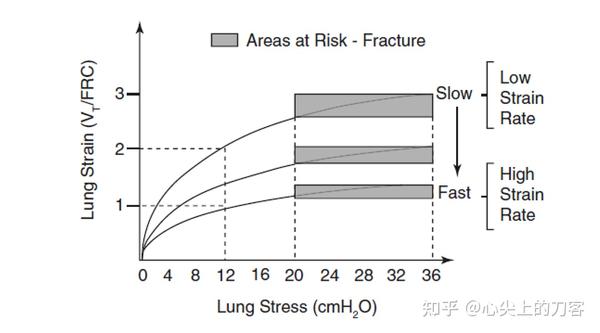 个性化机械通气设置——越慢越好 - 知乎