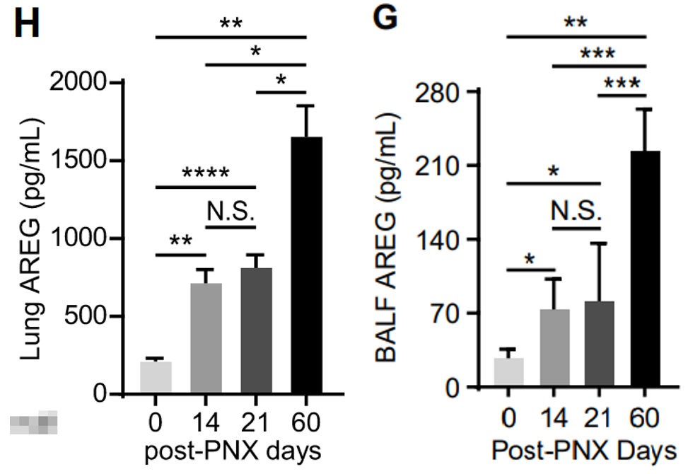 240919 文献精读Plus Cell Stem Cell AREG+肺纤维化 - 知乎