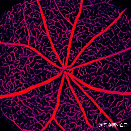 图像处理：血管分割与量化 - 知乎