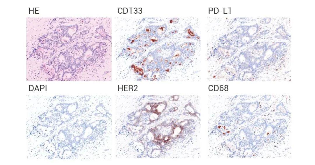 多重荧光免疫组化技术 (mIHC) 的原理什么，与 IHC 和 IF 有何区别？ - 知乎