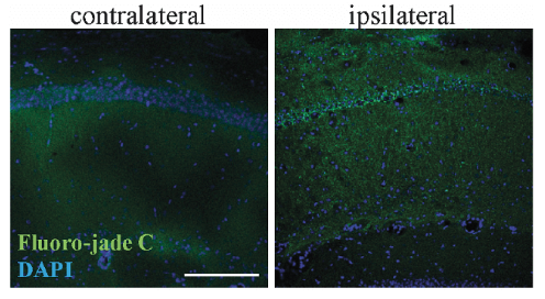 Fluoro-Jade C（FJC）染色试剂盒已发表高品质文章鉴赏 - 知乎
