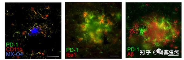 SCI | 阿尔茨海默病的生信研究现状与思路总结 - 知乎