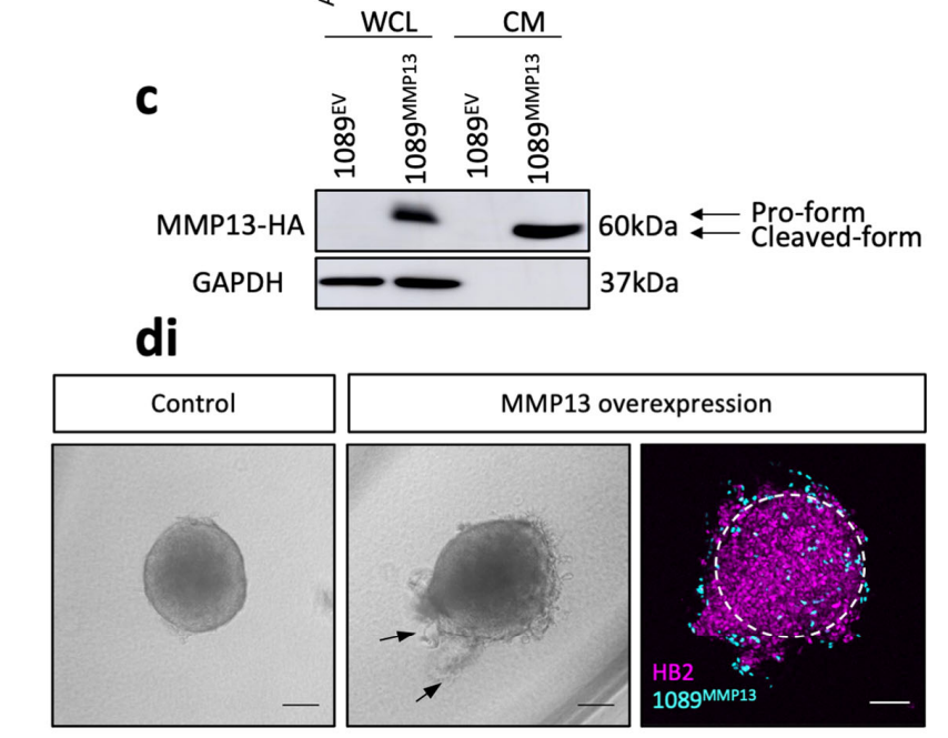 TGFβ-mediated MMP13 secretion drives myoepithelial cell dependent breast cancer progression - 知乎