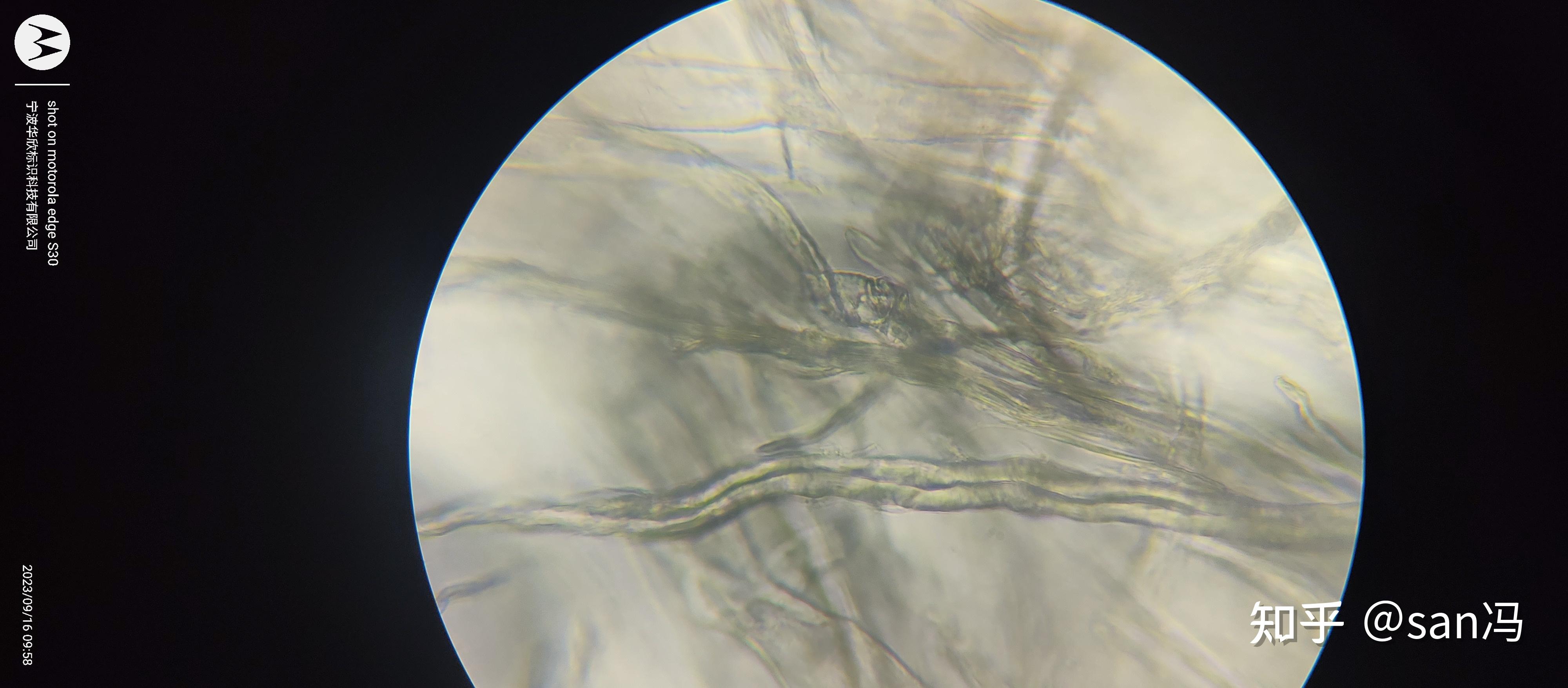 如何区分显微镜下的真菌？ - 知乎