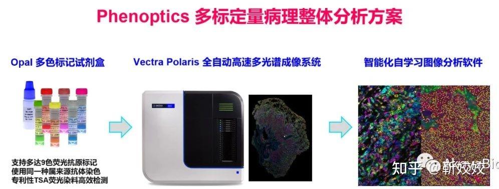 Nature热点|Akoya Opal多标分析方案助力B细胞功能与卵巢癌精准诊疗 - 知乎