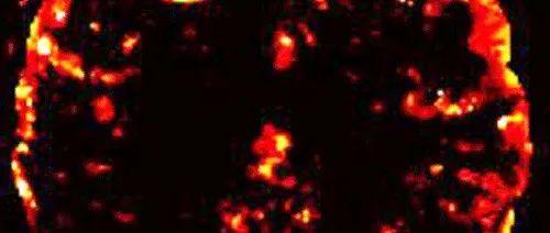 可以从 DCE图像中提取哪些量化参数？ - 知乎