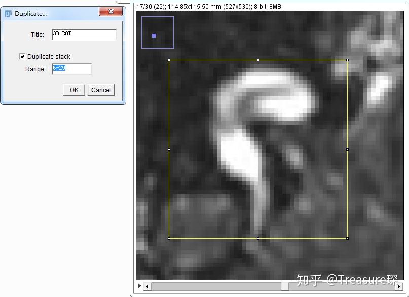 ImageJ实用技巧——3D可视化及测量(定量分析篇) - 知乎