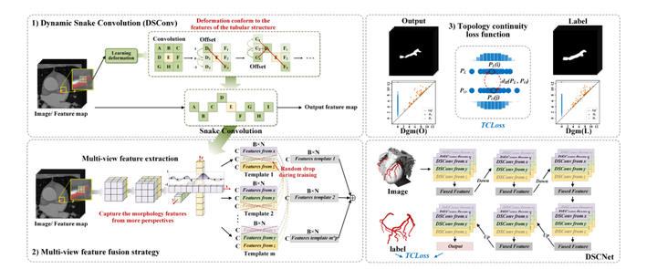 (即插即用模块-Convolution部分) 三、(ICCV 2023) DSConv 动态蛇形卷积 - 知乎