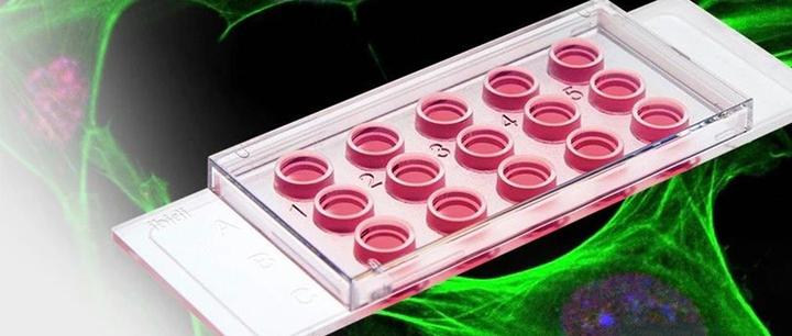 ibidi µ-Slide 15 Well 3D载玻片不仅仅是做血管生成实验，想知道更多吗？ - 知乎