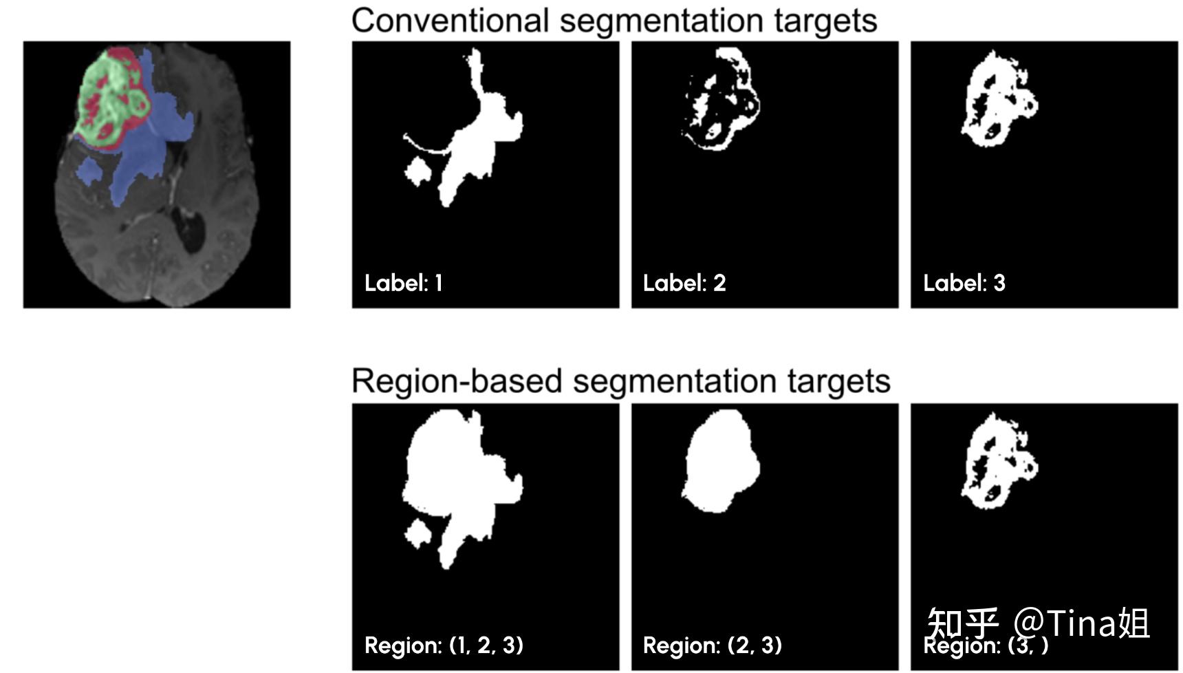 全网都在用的nnUNet V2版本改进了啥，怎么安装？（一） - 知乎