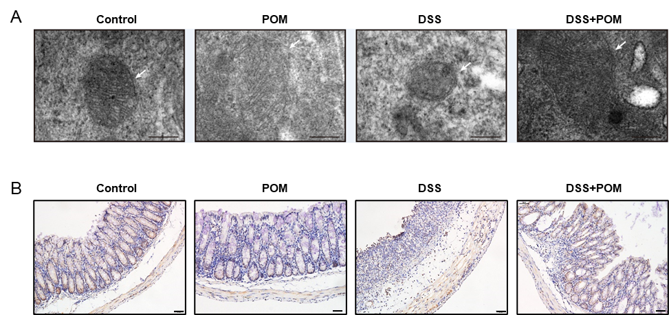 Pharmacol Res︱李丹团队发现钼基多金属纳米团簇（POM）通过清除ROS治疗溃疡性结肠炎 - 知乎
