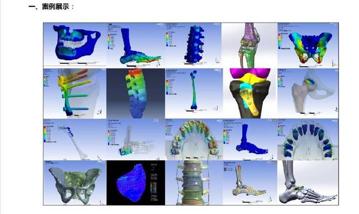 Mimics软件在医学中应用简介 - 知乎