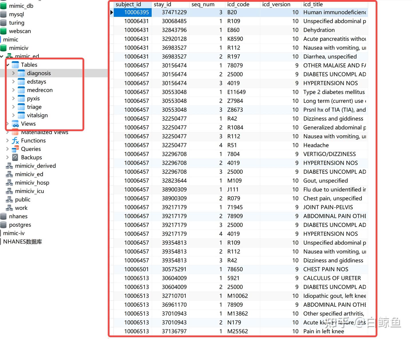 MIMIC数据库文献分享和重现：评估 MIMIC-IV v2.2 和 MIMIC-IV-ED 数据集中的不同诊断 - 知乎