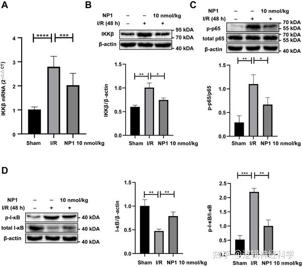 J Neuroinflammation︱昆明医科大学杨新旺团队阐述：短肽通过miR-6328/IKKβ/NF-κB轴减轻炎症对脑缺血再灌注损伤发挥神经保护作用 - 知乎
