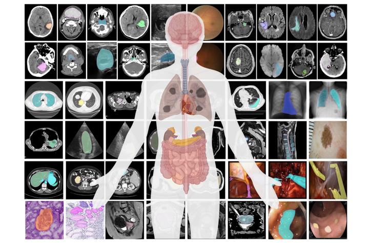 SCI 1区论文：Segment anything in medical images（MedSAM）[文献阅读] - 知乎