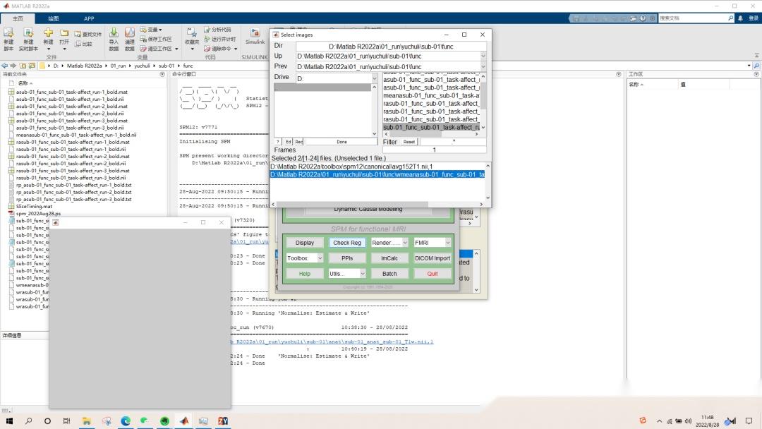 如何用SPM完成fMRI数据的预处理【任务态】 - 知乎