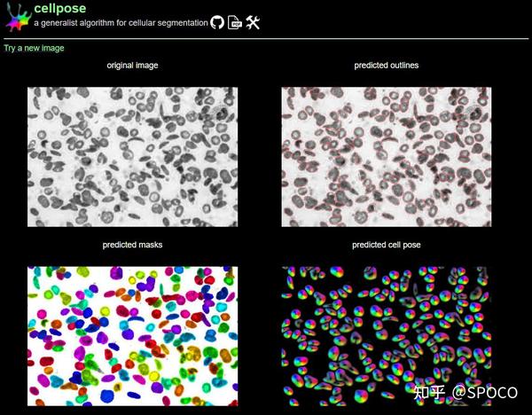 生物图像分割开源工具图鉴（未完待续） - 知乎