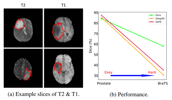 论文笔记21：Generalizable Cross-modality Medical Image Segmentation via ...