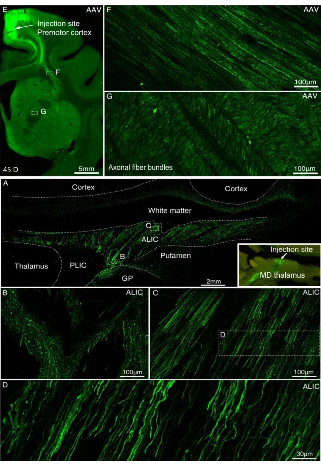 AAV、VSV和 LV在猕猴上的应用 - 知乎