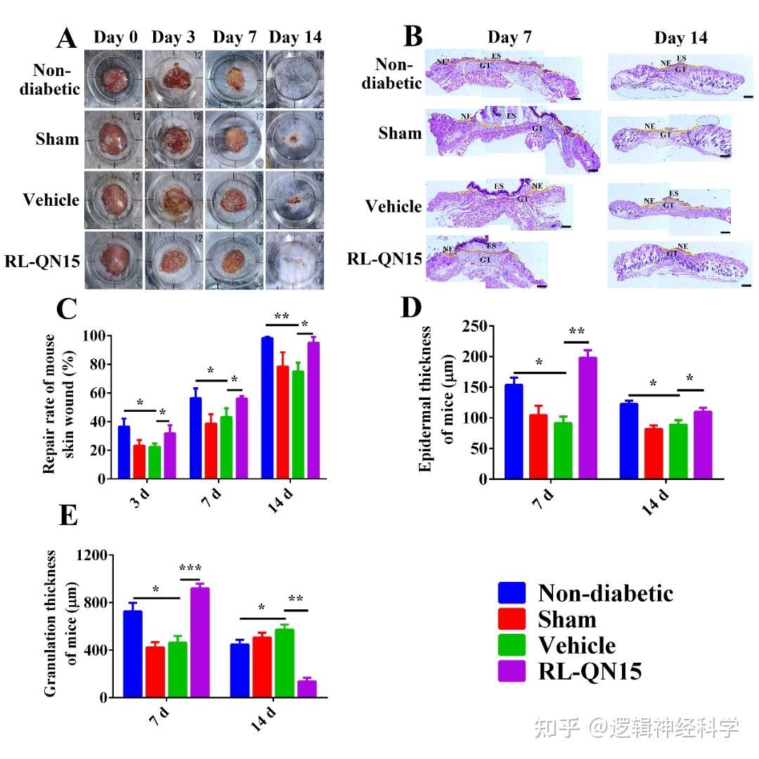 The FASEB Journal︱昆明医科大学杨新旺团队报道活性肽RL-QN15促进糖尿病皮肤伤口表皮神经纤维再生以及感觉功能恢复 - 知乎