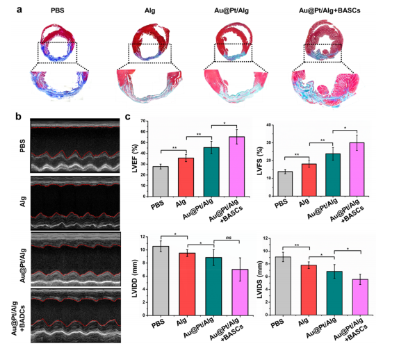 《ACS NANO》: 包裹双功能 Au@Pt 核壳纳米颗粒可注射水凝胶调节梗死微环境,并通过抗氧化和电整合提高干细胞治疗效果 - 知乎