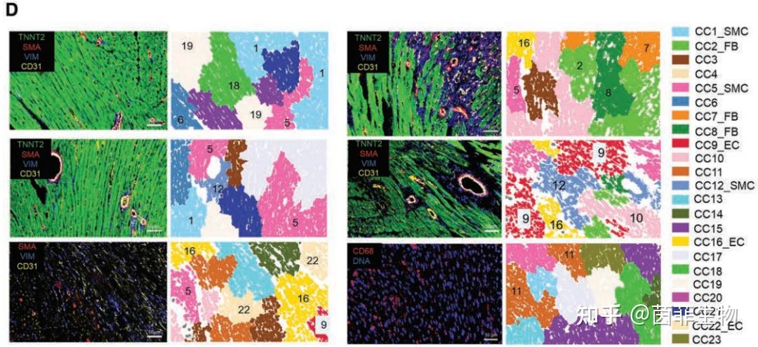 Circ Res | IMC绘制小鼠心肌缺血再灌注损伤的单细胞蛋白修饰时空图谱 - 知乎