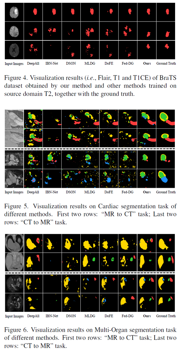 论文笔记21：Generalizable Cross-modality Medical Image Segmentation via Style Augmentation and Dual ...