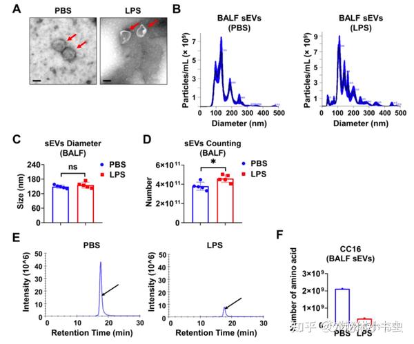 文献分享【Mol. Ther.】外泌体装载CC16蛋白治疗肺急性炎症反应 - 知乎