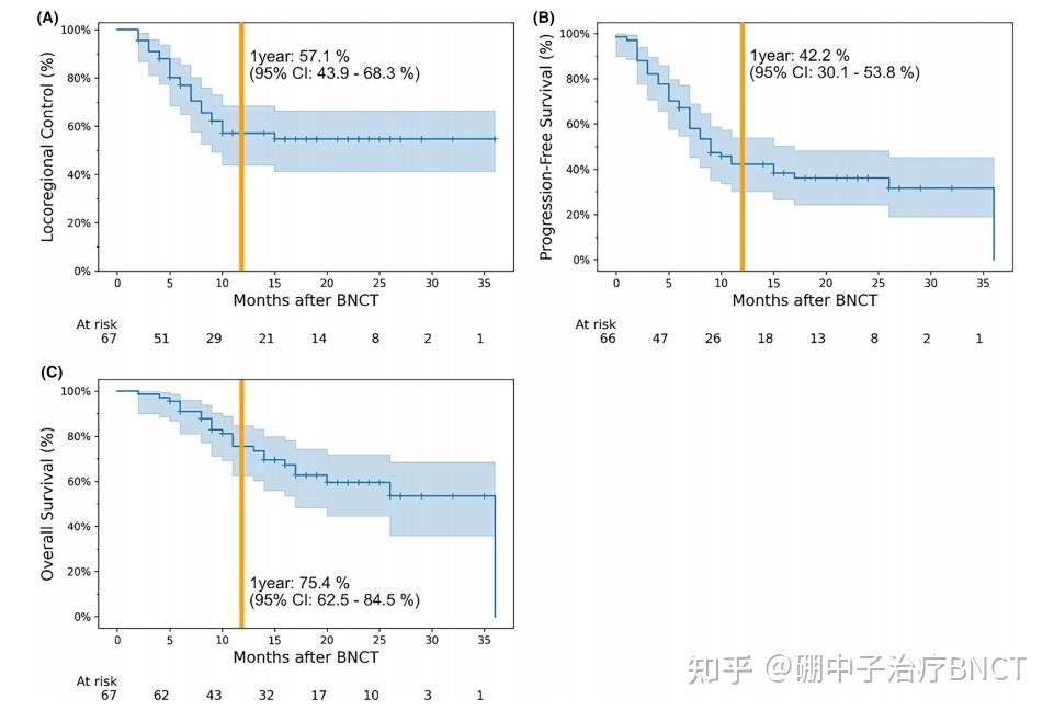 两年经验总结！日本BNCT治疗头颈部肿瘤的早期真实世界研究成果 - 知乎