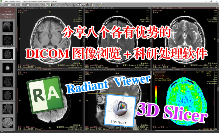 DICOM 图像浏览器和影像科研平台推荐（附 Radiant Viewer、3D Slicer 安装包） - 知乎